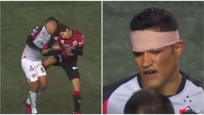 VIDEO Anderson Santamaría recibió durísimo golpe en rostro en Atlas ...